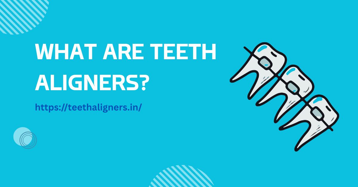 What Are Teeth Aligners? Discover How They Really Work